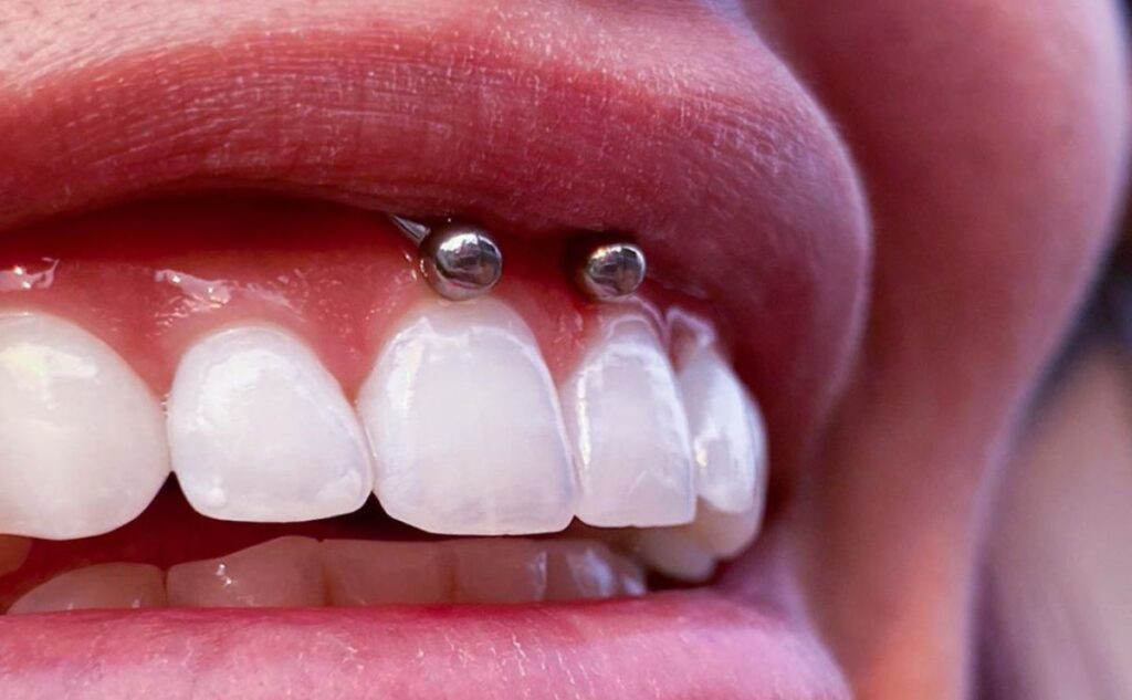 Piercing smiley. Cuidados, recomendaciones y joyas